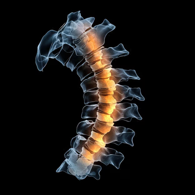 Spinal Decompression for Herniated & Bulging - The Decompression Clinic